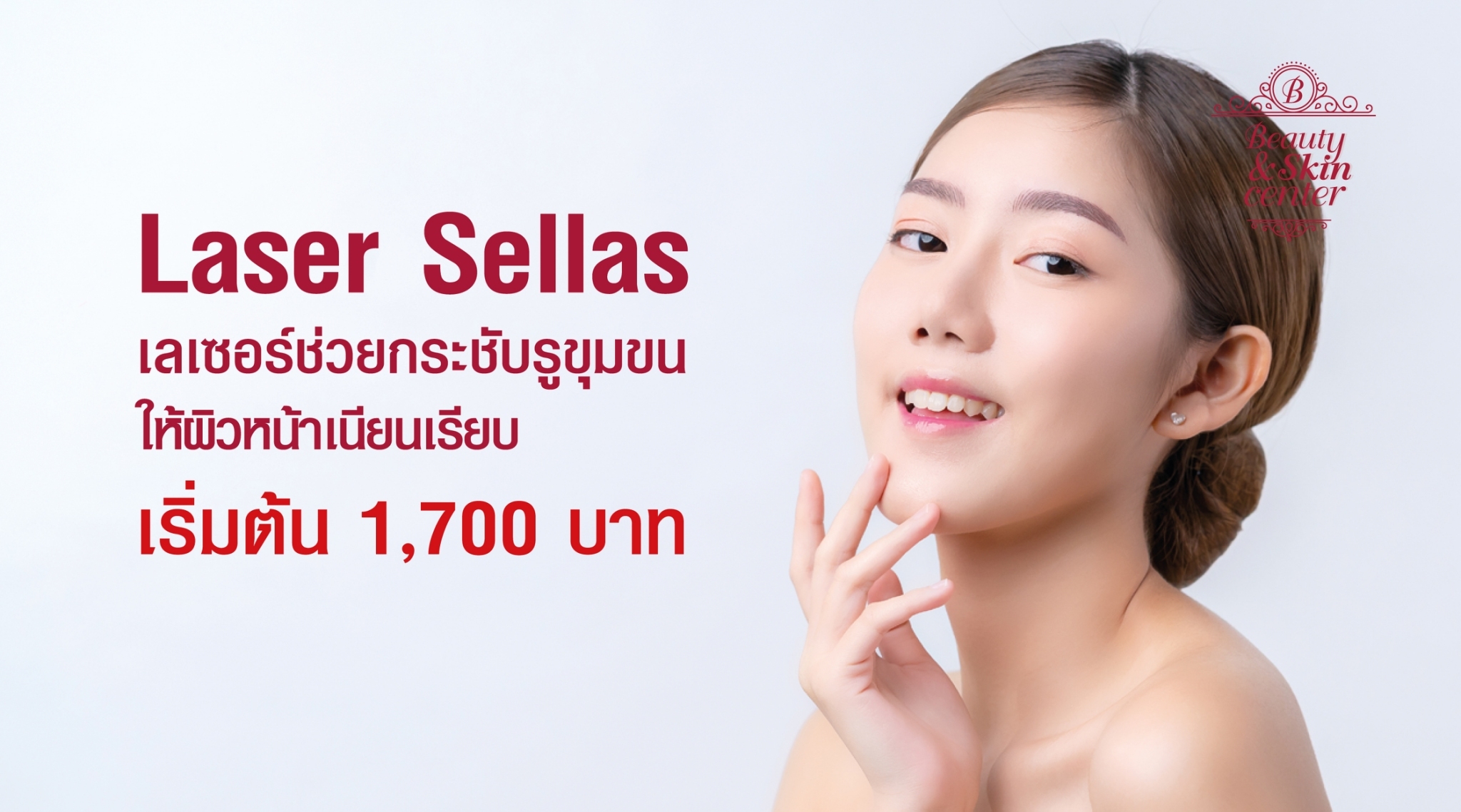 Laser Sellas