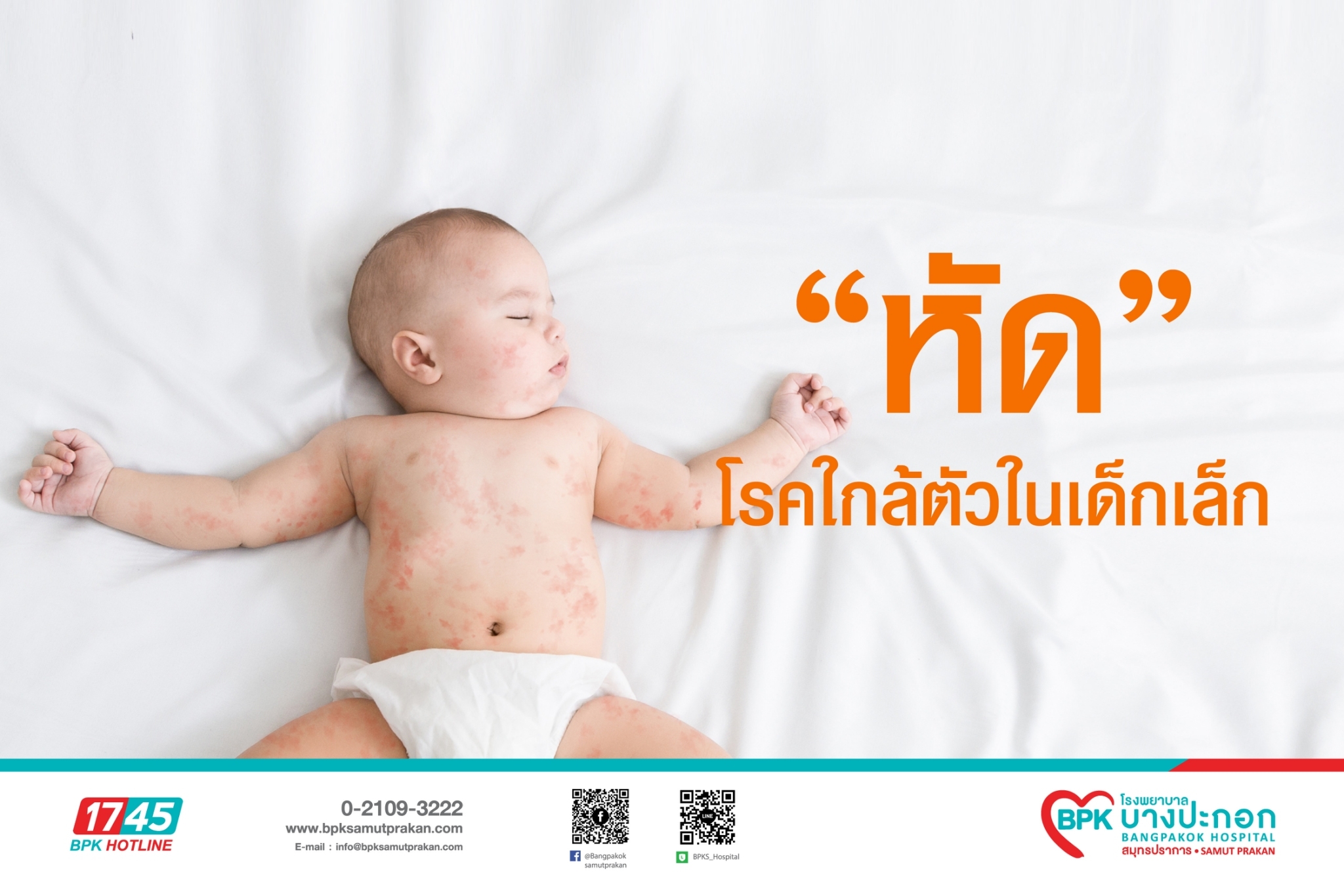 “หัด” โรคใกล้ตัวในเด็กเล็ก